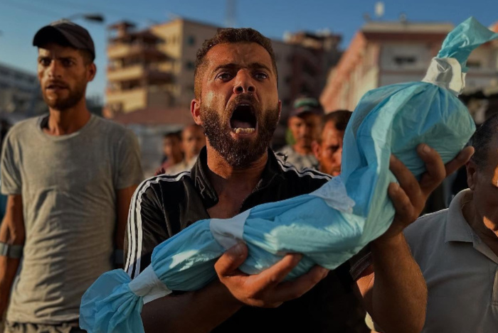 Tomber d'inanition dans les rues de Gaza pour cause de famine